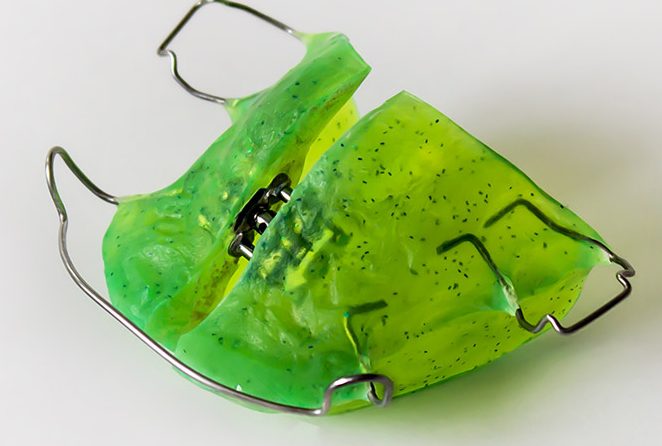 Removable Retainers | Hometown Orthodontics